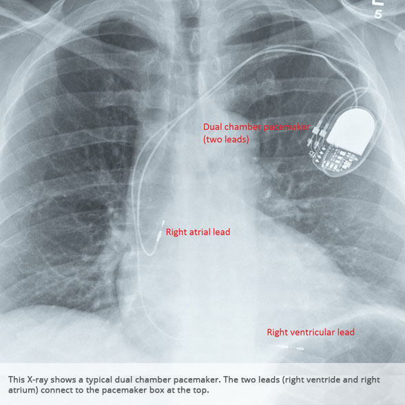 Dr Bogdan Nuta X rays And Descriptions Of Cardiology Procedures